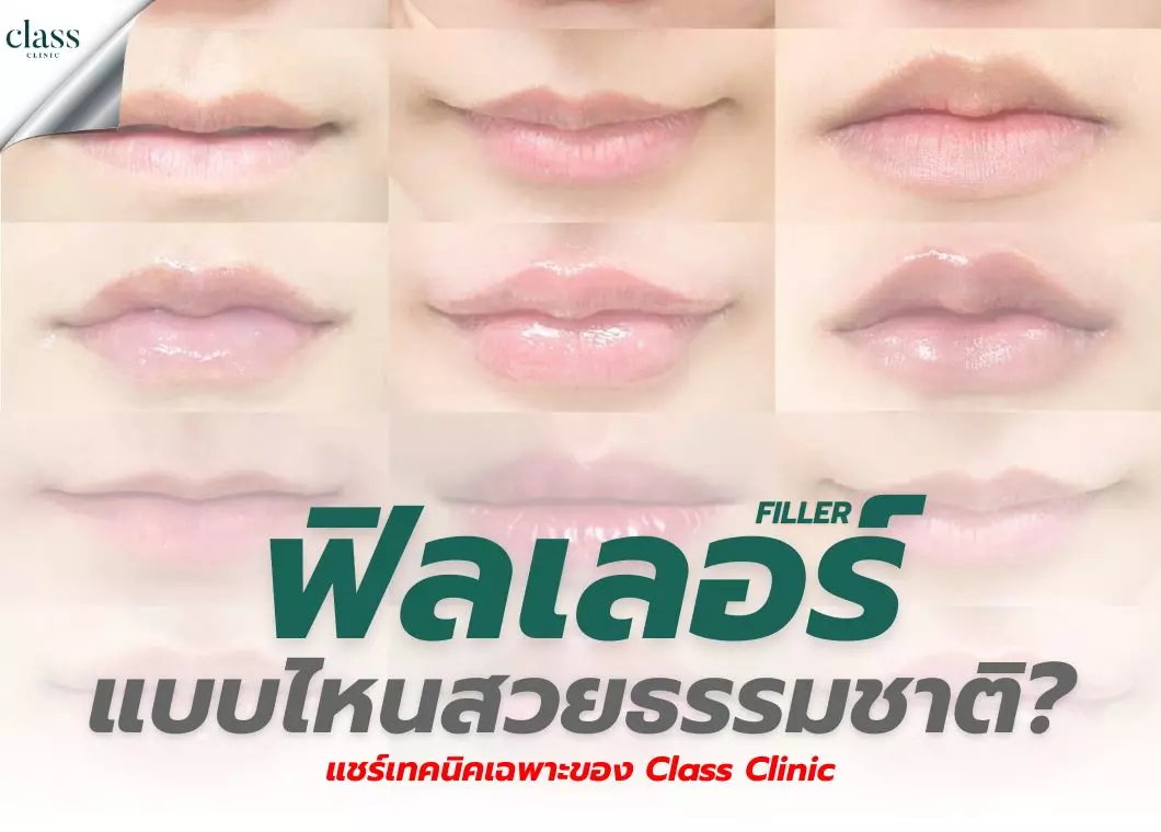 ฟิลเลอร์ปากอุดรธานี แบบไหนสวยธรรมชาติ? แชร์เทคนิคเฉพาะของ Class Clinic ...
